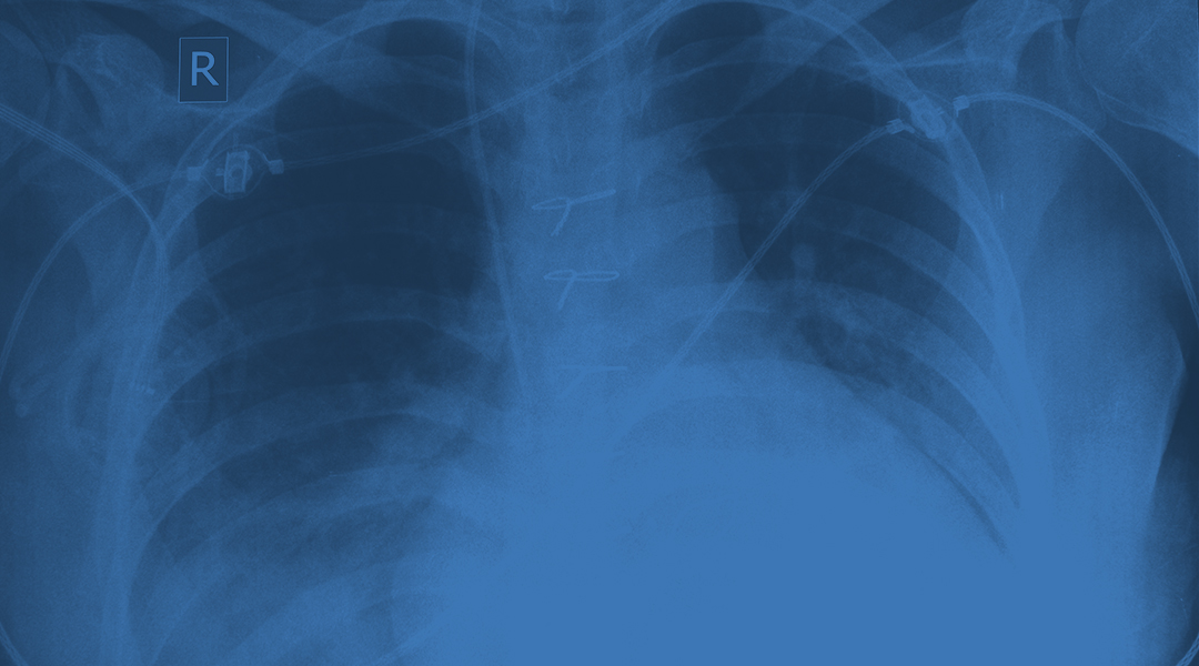 respiratory_blue : Emergency Care BC